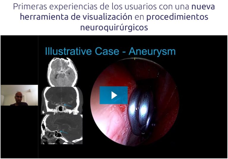Primeras experiencias de los usuarios del QEVO de ZEISS en ...